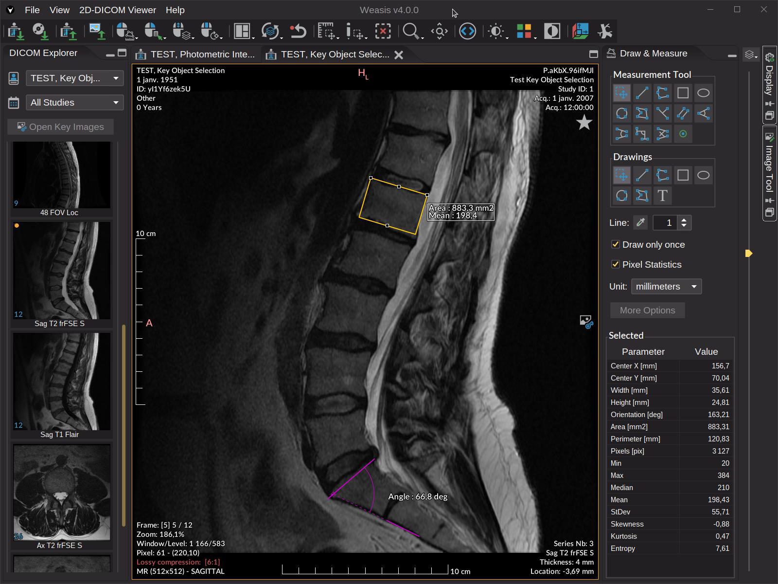 Weasis: Free DICOM viewer :: Weasis Documentation